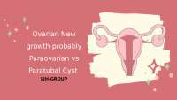 Paraovarian and Paratubal Cyst - Docsity