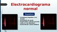 Electrocardiograma normal - Docsity