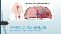 Analiza y entiende con precisión de qué trata la embolia pulmonar ...