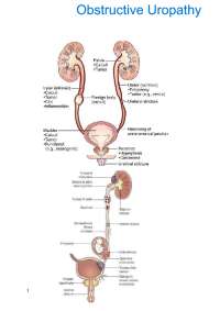 Obstructive Uropathy | Study Guides, Projects, Research Medical ...